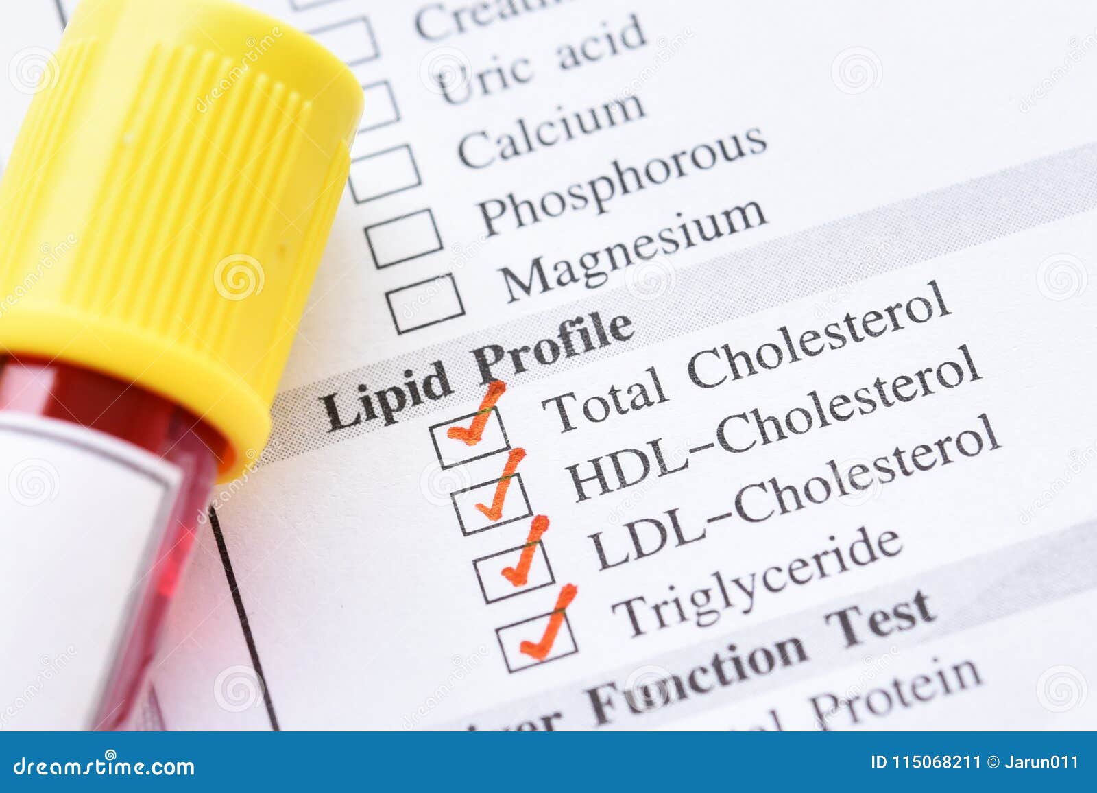 Lipid profile test stock image. Image of lipoprotein - 115068211 Lipid profile test stock image. Image of lipoprotein - 115068211
