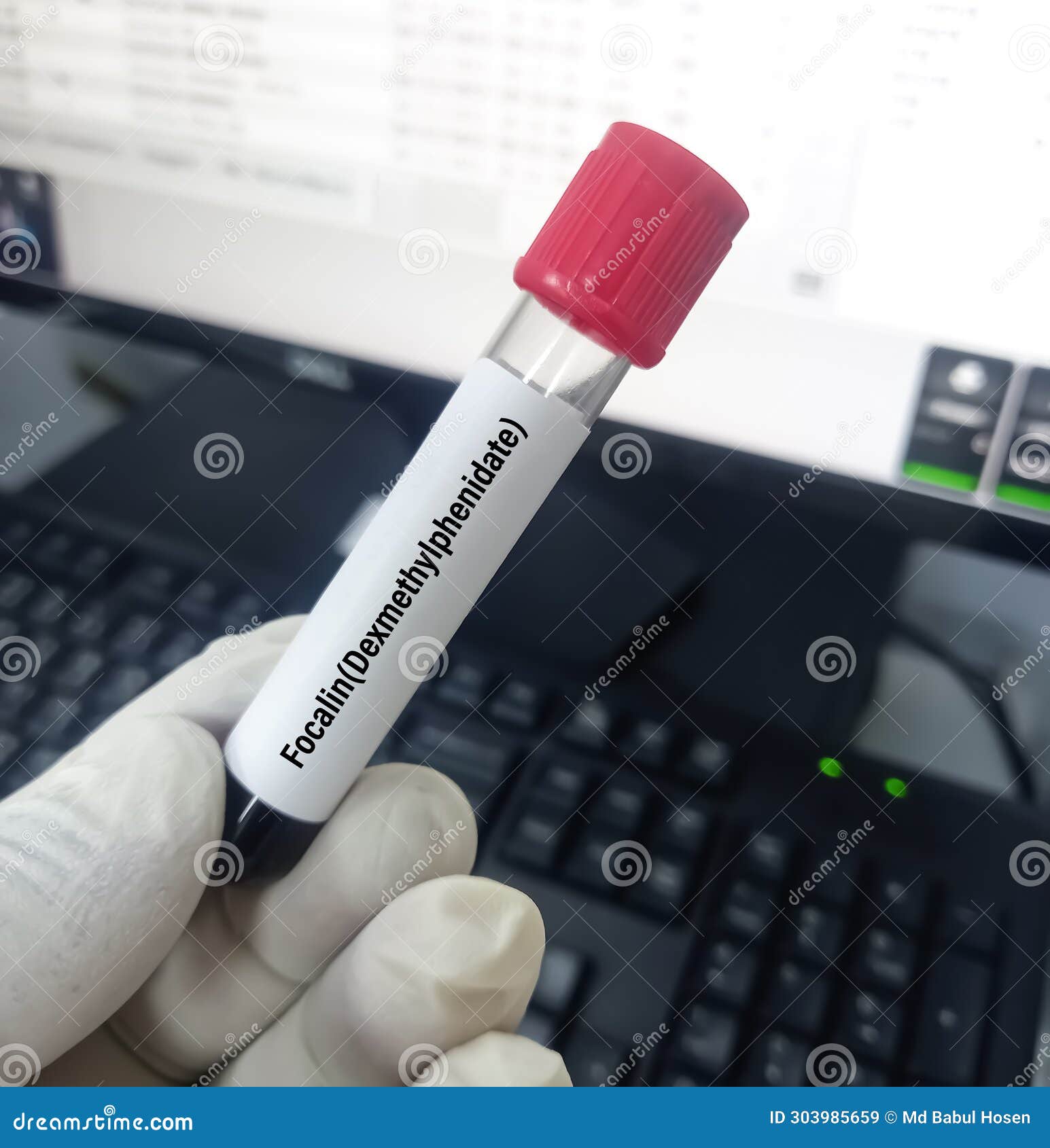 Blood Sample for Methylphenidate or Retalin Test. Stimulant Used for ...