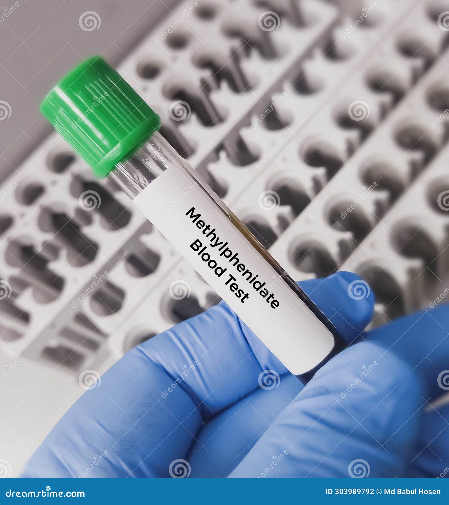 Blood Sample for Methylphenidate or Retalin Test Used for Attention ...