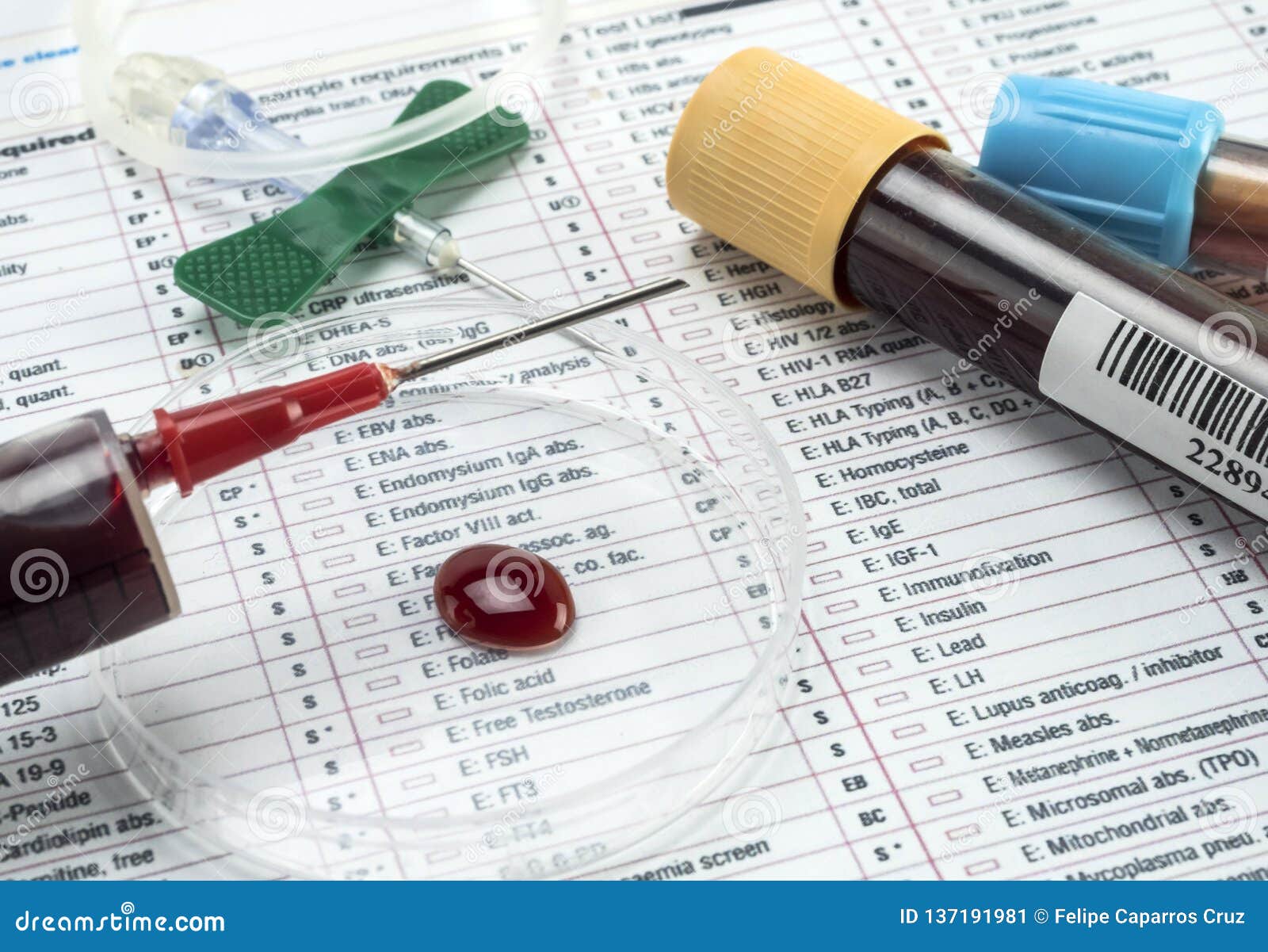 Blood Sample on a Petri Disc Along with Syringe in a Laboratory Stock ...
