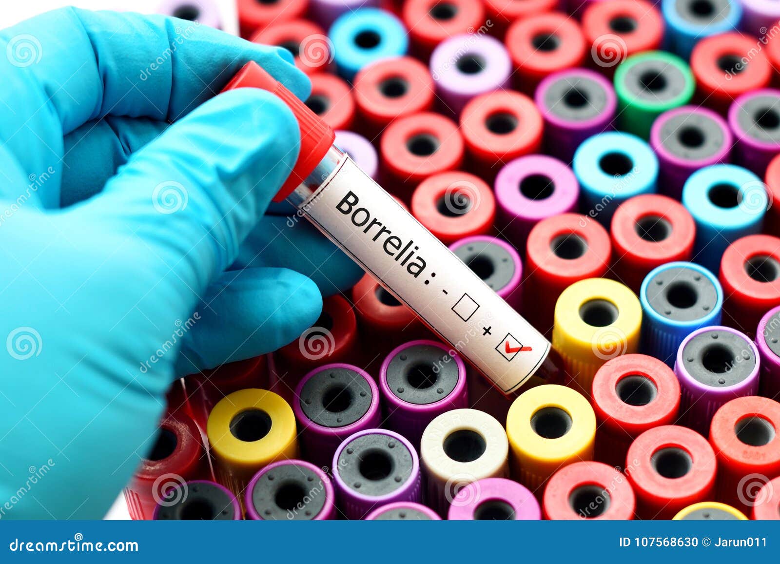 Blood Sample Positive with Borrelia Test Stock Photo - Image of ...