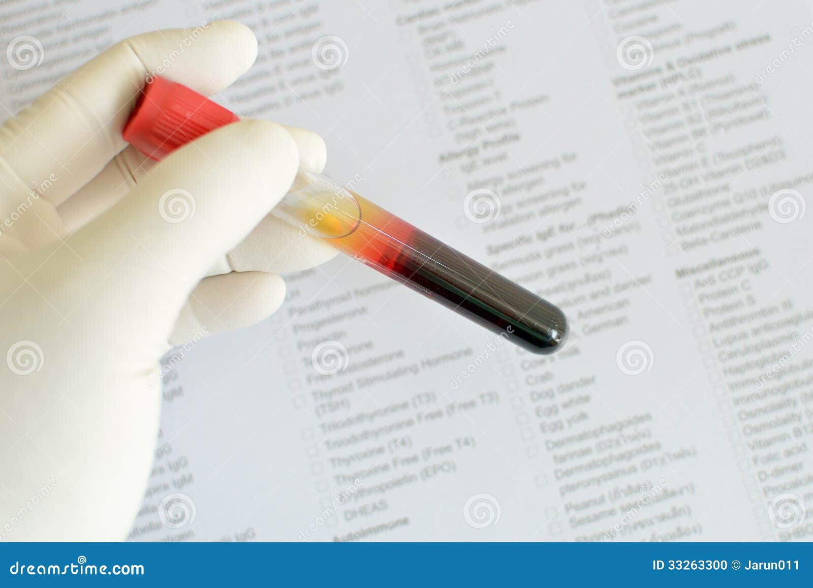 Blood sample stock photo. Image of test, blood, research - 33263300