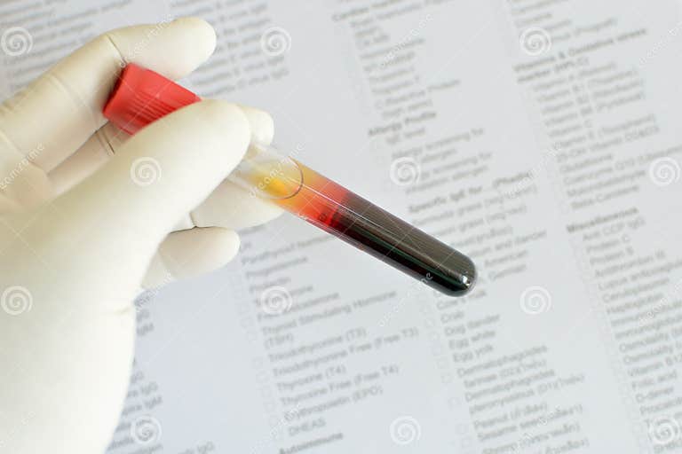 Blood sample stock photo. Image of test, blood, research - 33263300