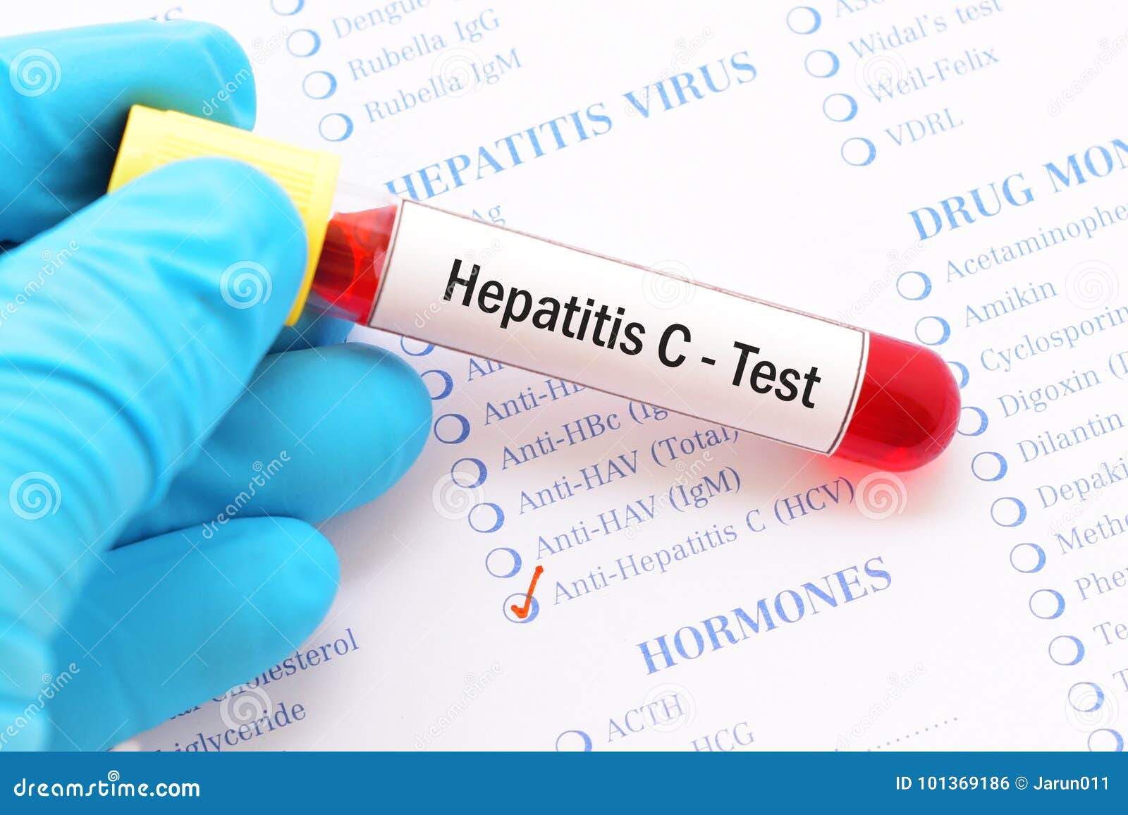 Hepatitis C test stock photo. Image of checkup, blood - 101369186