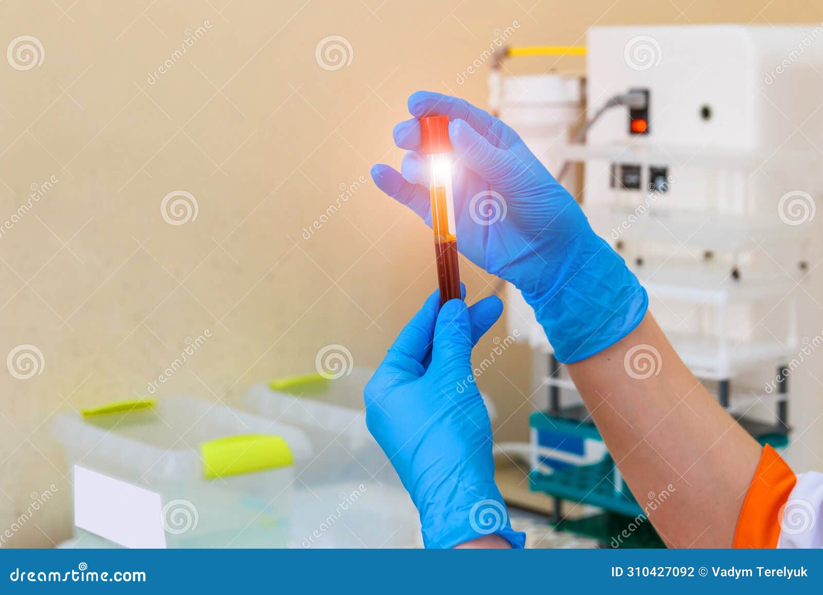 Blood Sample for Research in Microtube. Testing in Laboratory. Chemical ...