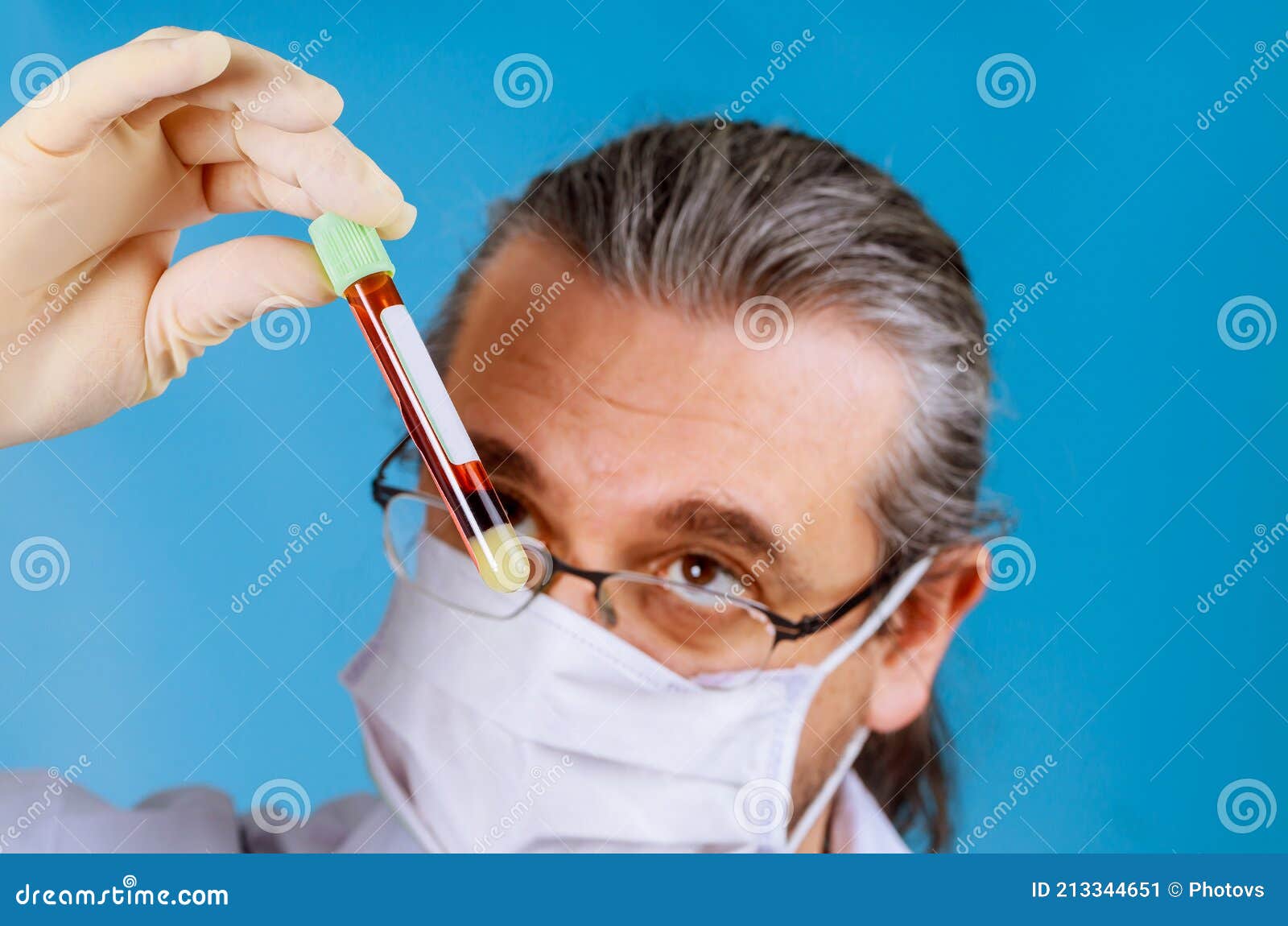 Blood Sample Screening Test on a Laboratory Stock Image - Image of ...