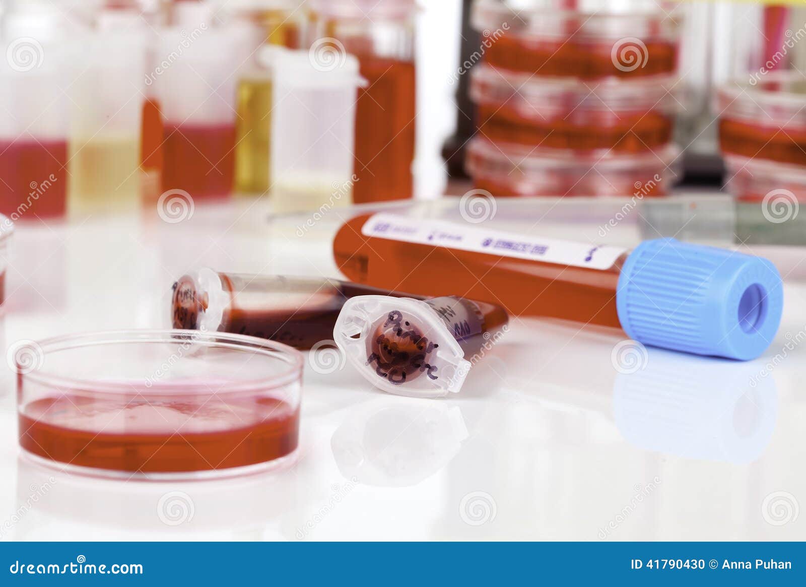 Blood sample stock photo. Image of genetic, biology, analysis - 41790430