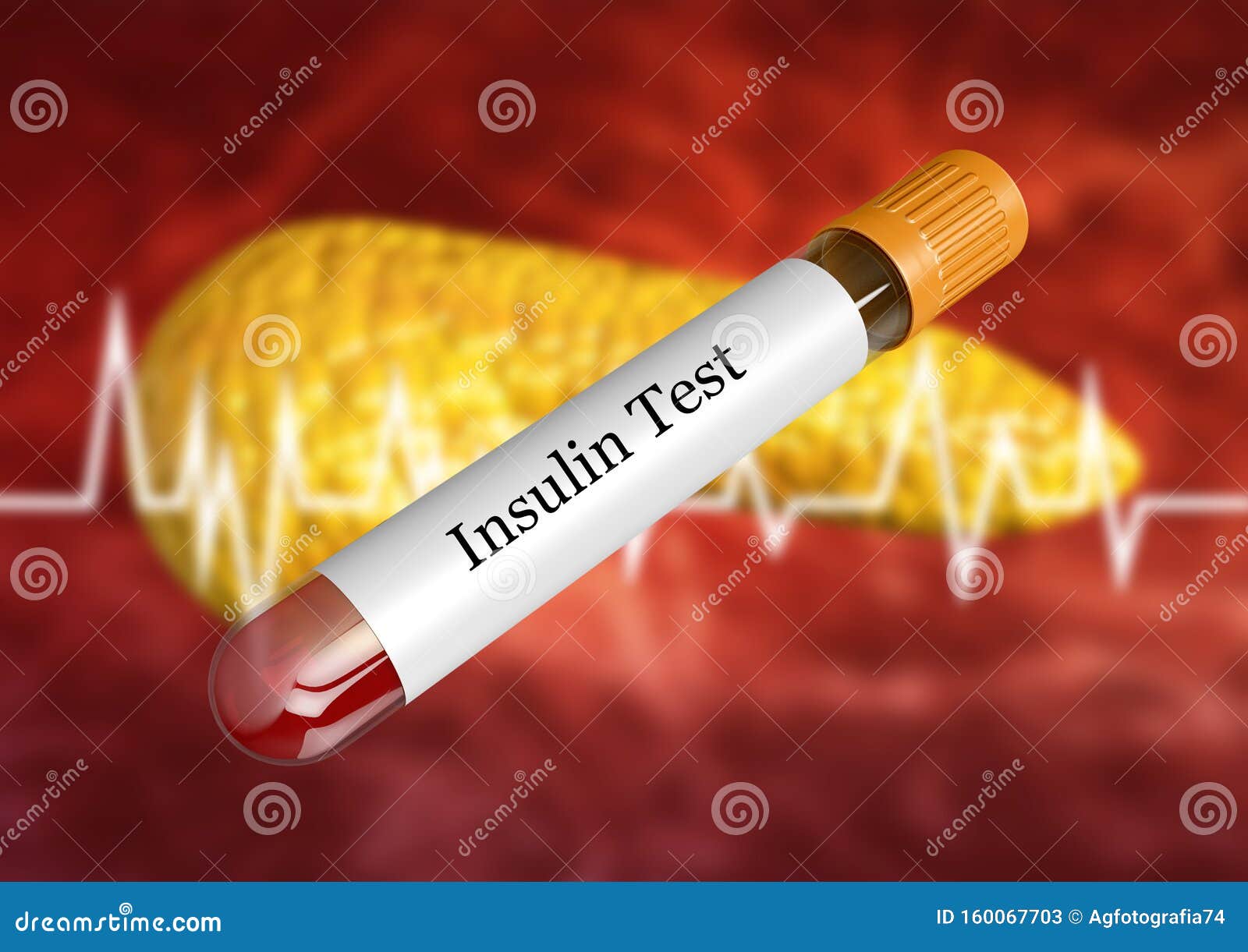 Blood Sample in Test Tube for Laboratory Insulin Test Stock ...