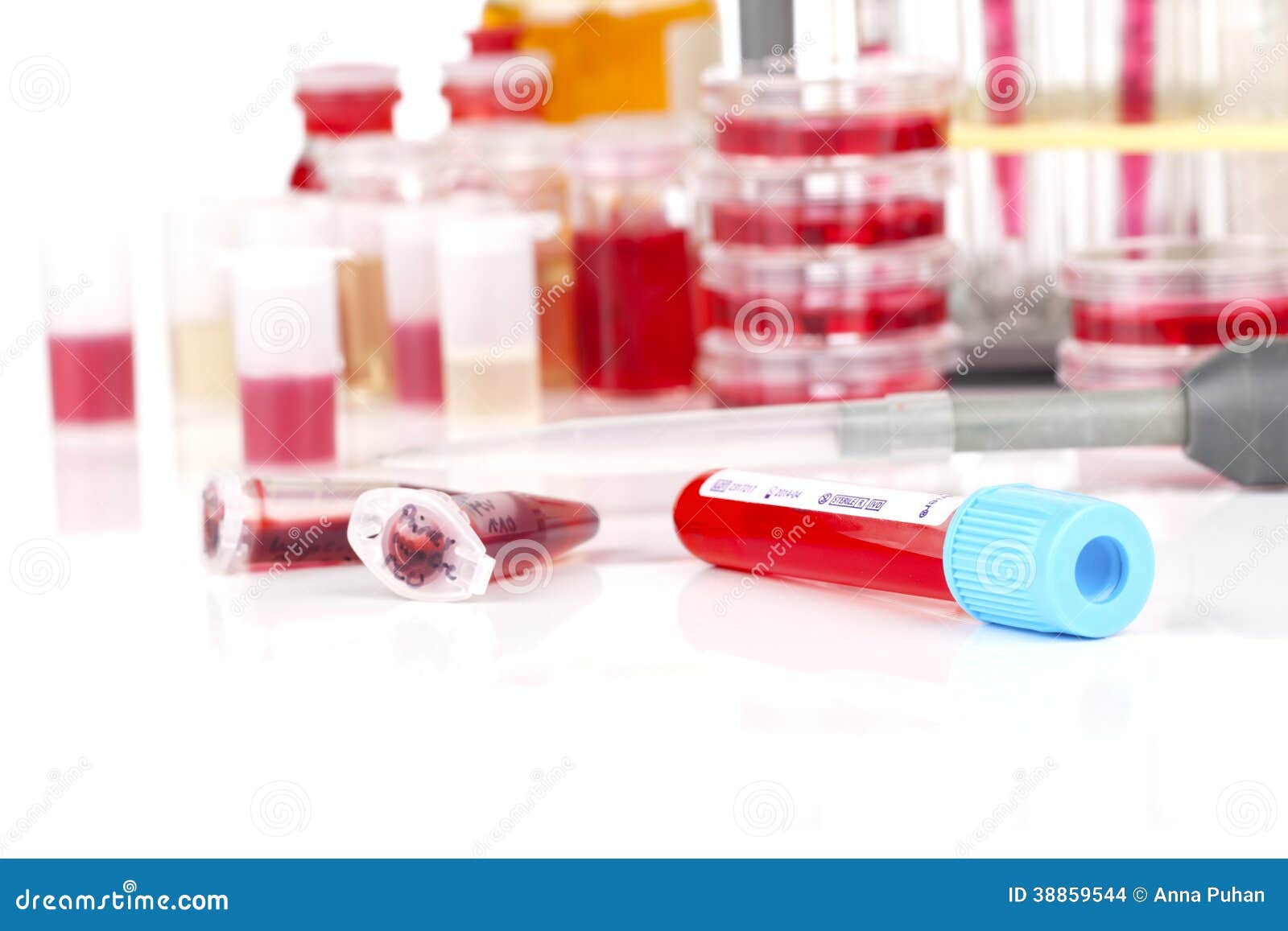 Blood Sample in a Test Tube Stock Photo - Image of glassware ...