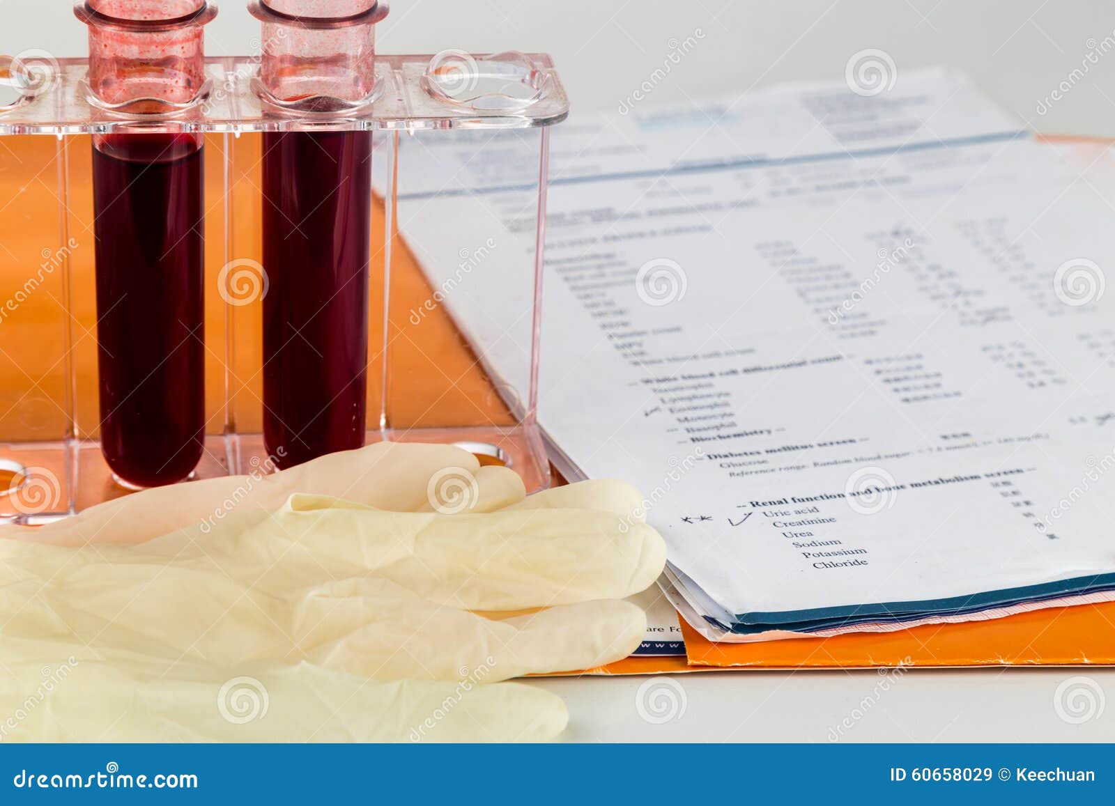 Blood Sample in Test Tubes with Health Analysis Screening Report Stock ...