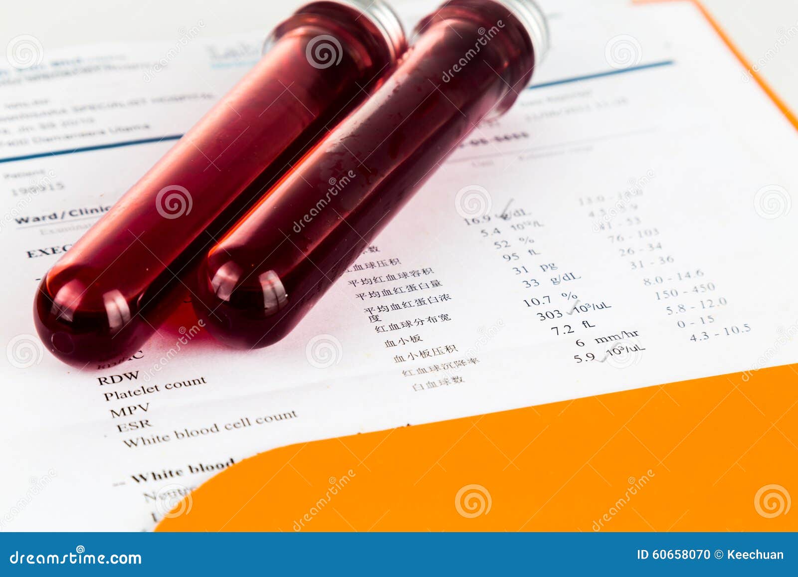 Blood Sample in Test Tubes with Health Analysis Screening Report Stock ...