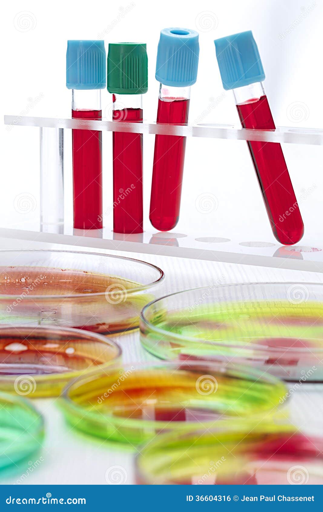 Blood Sample in Test Tubes and Petri Dishes Stock Photo - Image of help ...