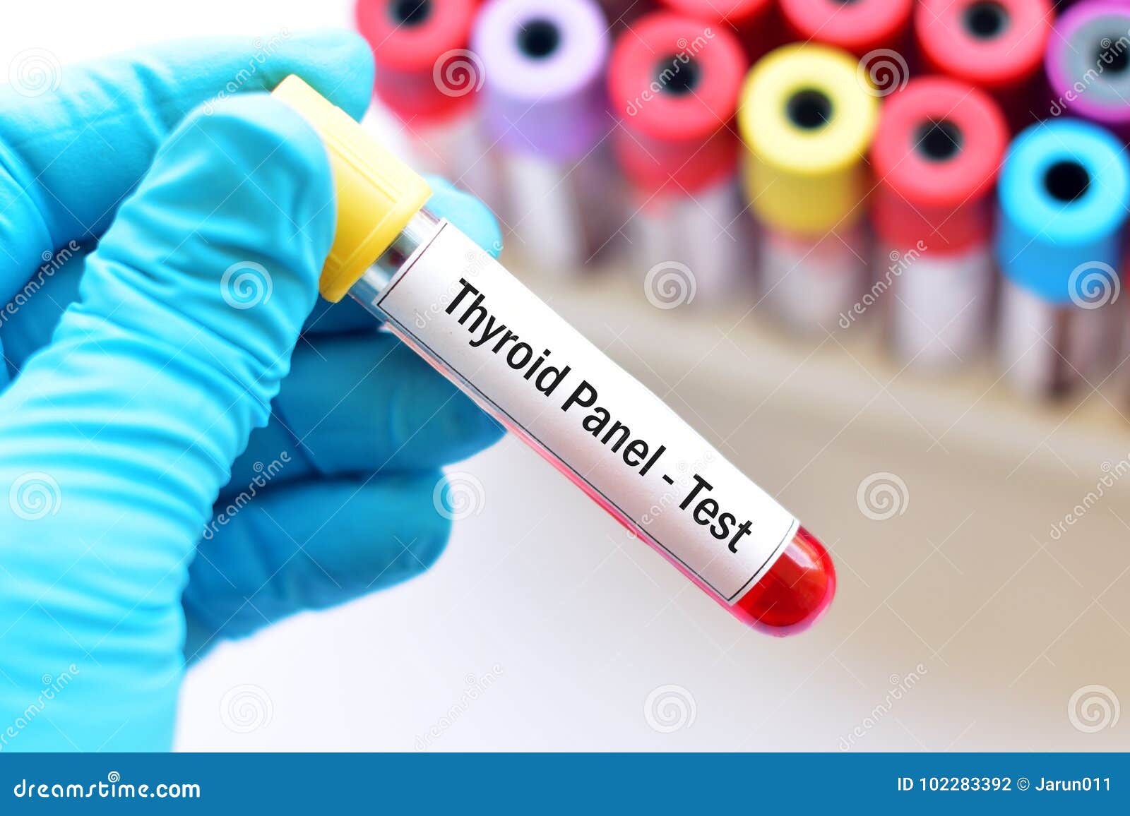 Thyroid panel test stock photo. Image of goiter, thyroid - 102283392