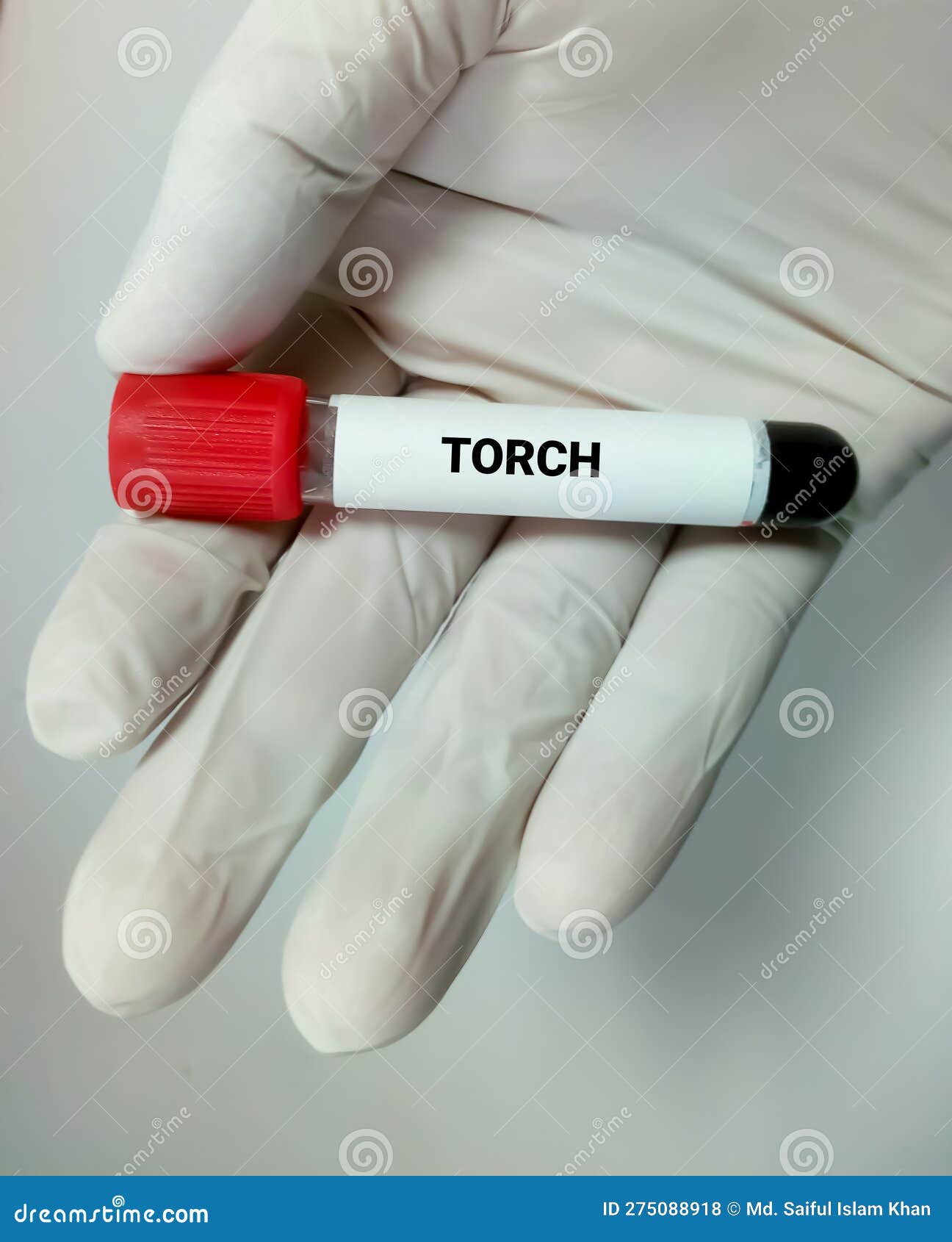 Blood Sample for TORCH Test. TORCH Panel Stock Photo - Image of ...