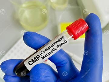 CMP or Comprehensive Metabolic Panel in Laboratory. Stock Image - Image ...