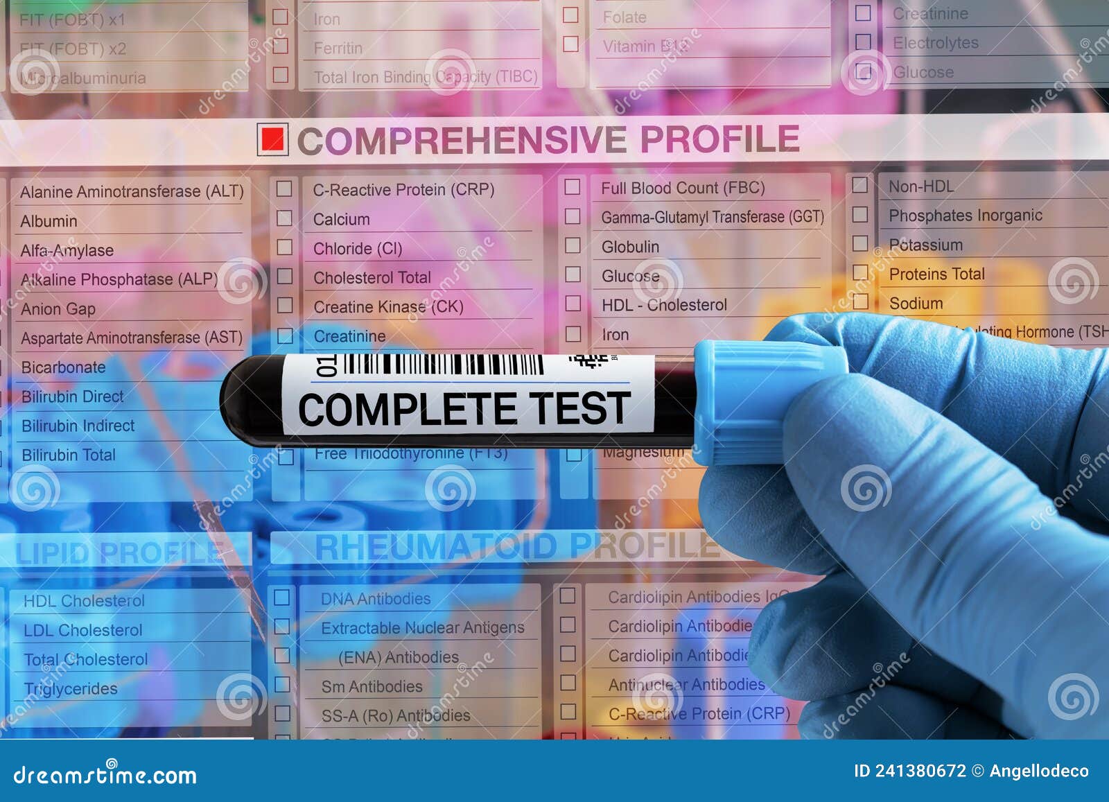Blood Tube Test with Requisition Form for Complete Blood Test Stock ...