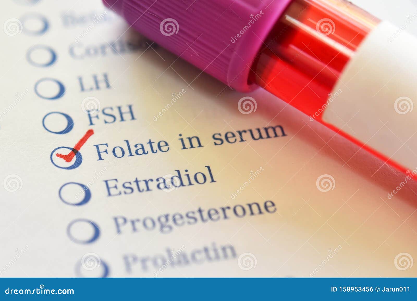 Blood Sample Tube for Folate Test Stock Photo - Image of form, folate ...