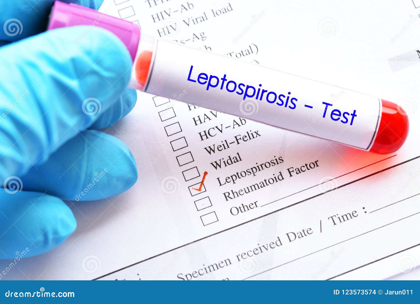 Blood Sample Tube for Leptospirosis Test Stock Photo - Image of ...