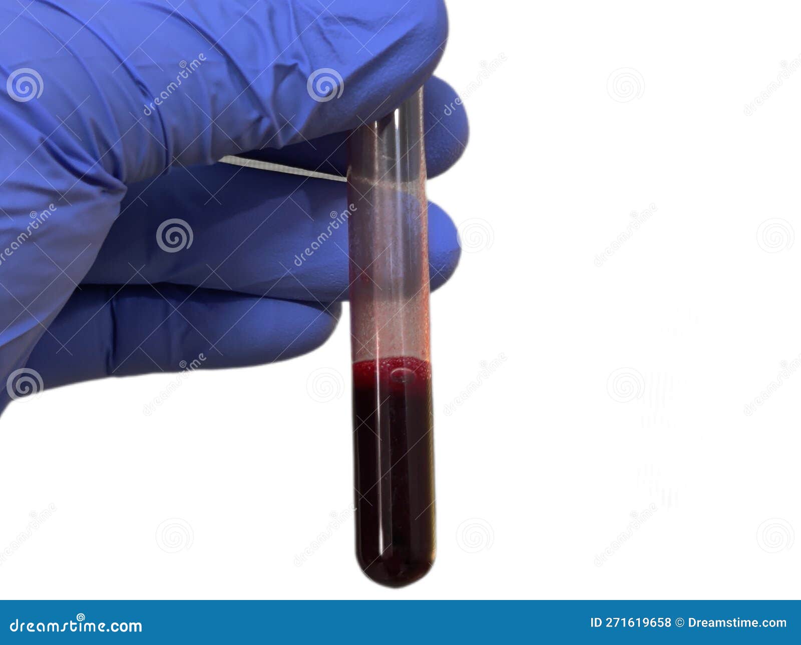 Blood Sample Tube for Medical Laboratory Test. Stock Photo - Image of ...