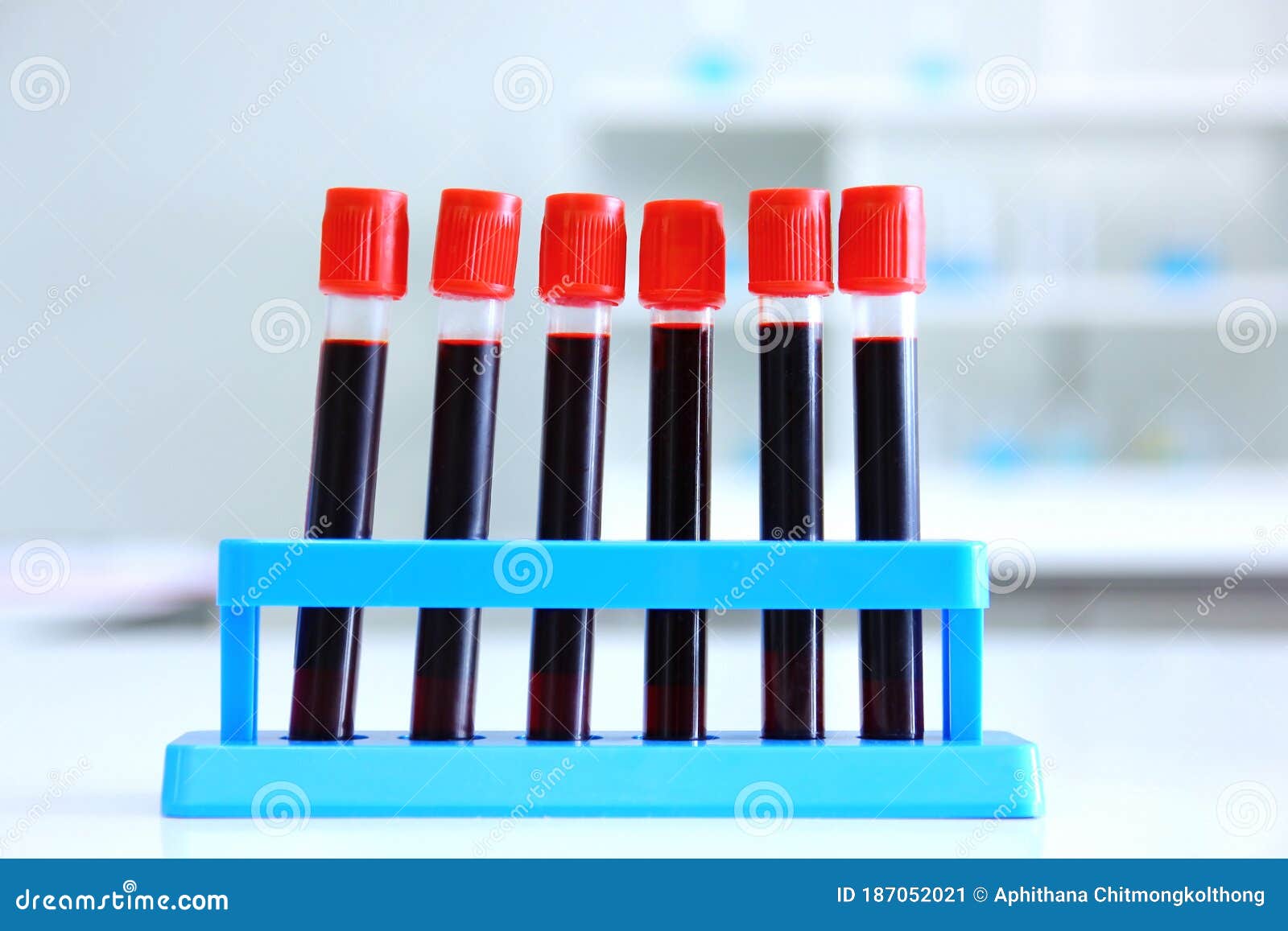 Blood Sample Tube from Patient in Laboratory Stock Image - Image of ...