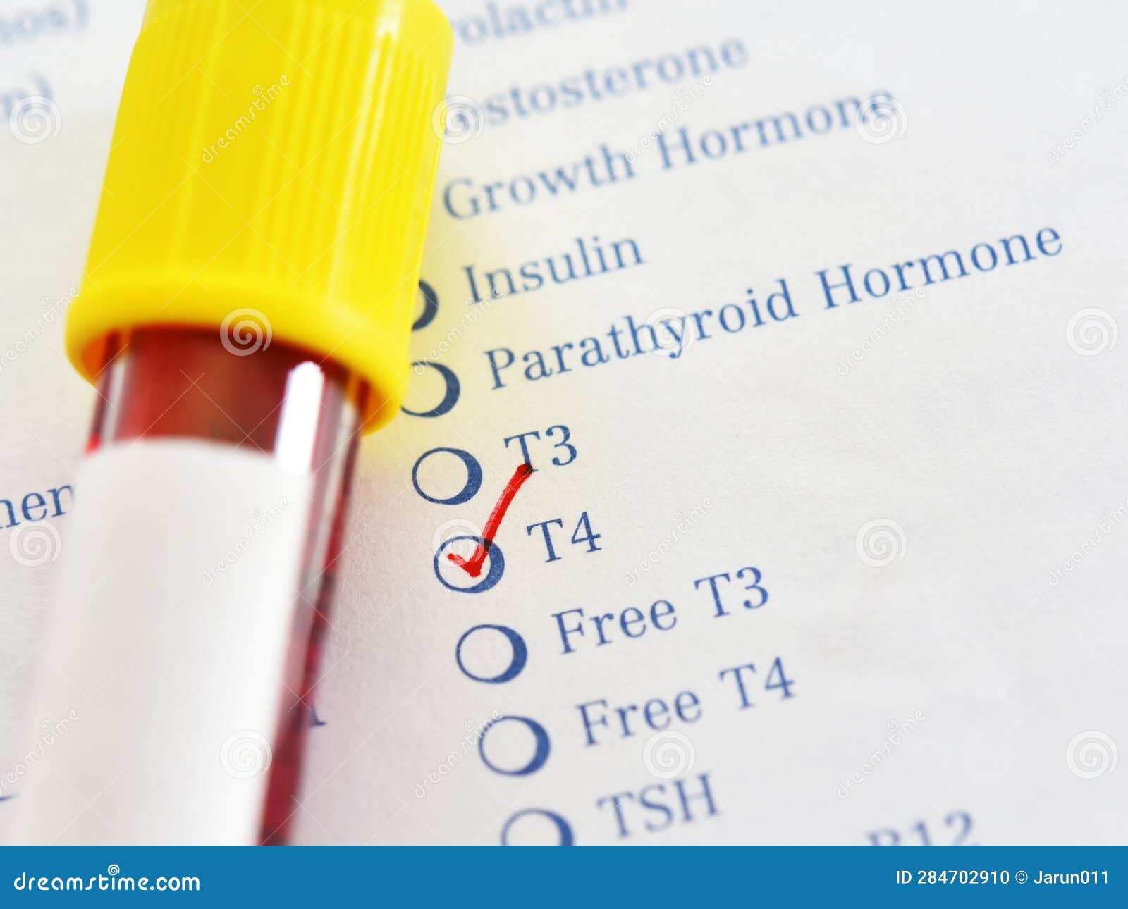 Blood Sample Tube for Thyroxine (T4) Test Stock Photo - Image of ...