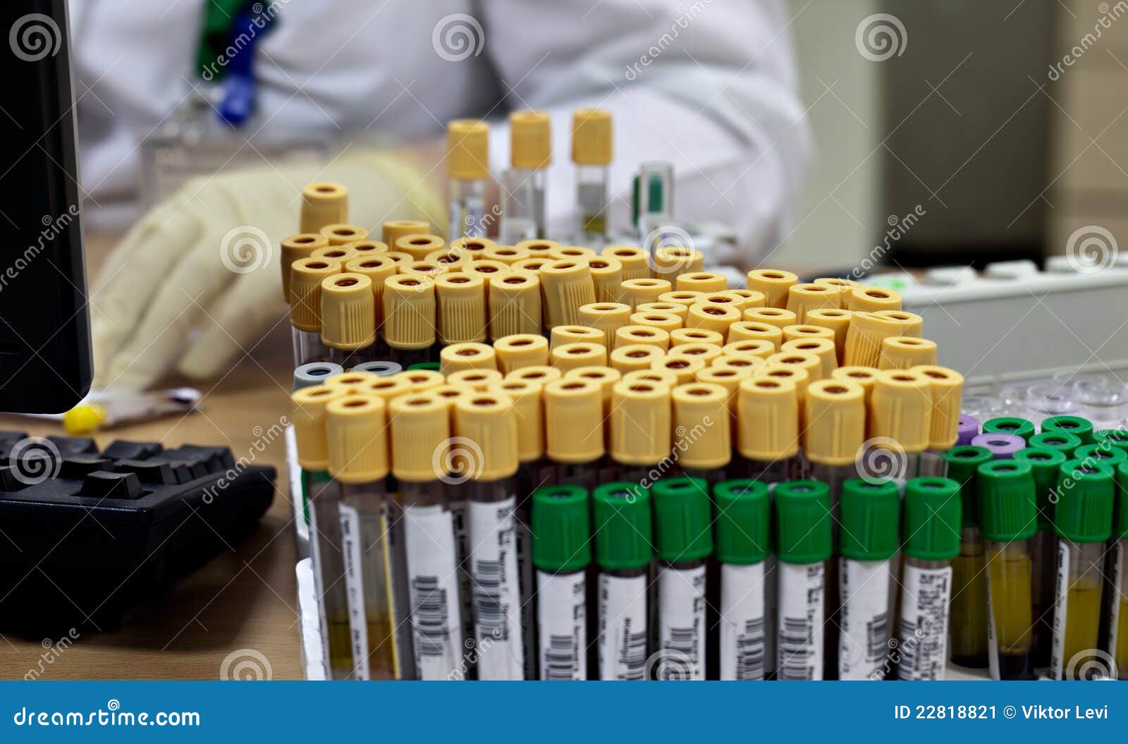 Blood sample tubes stock image. Image of test, healthcare - 22818821