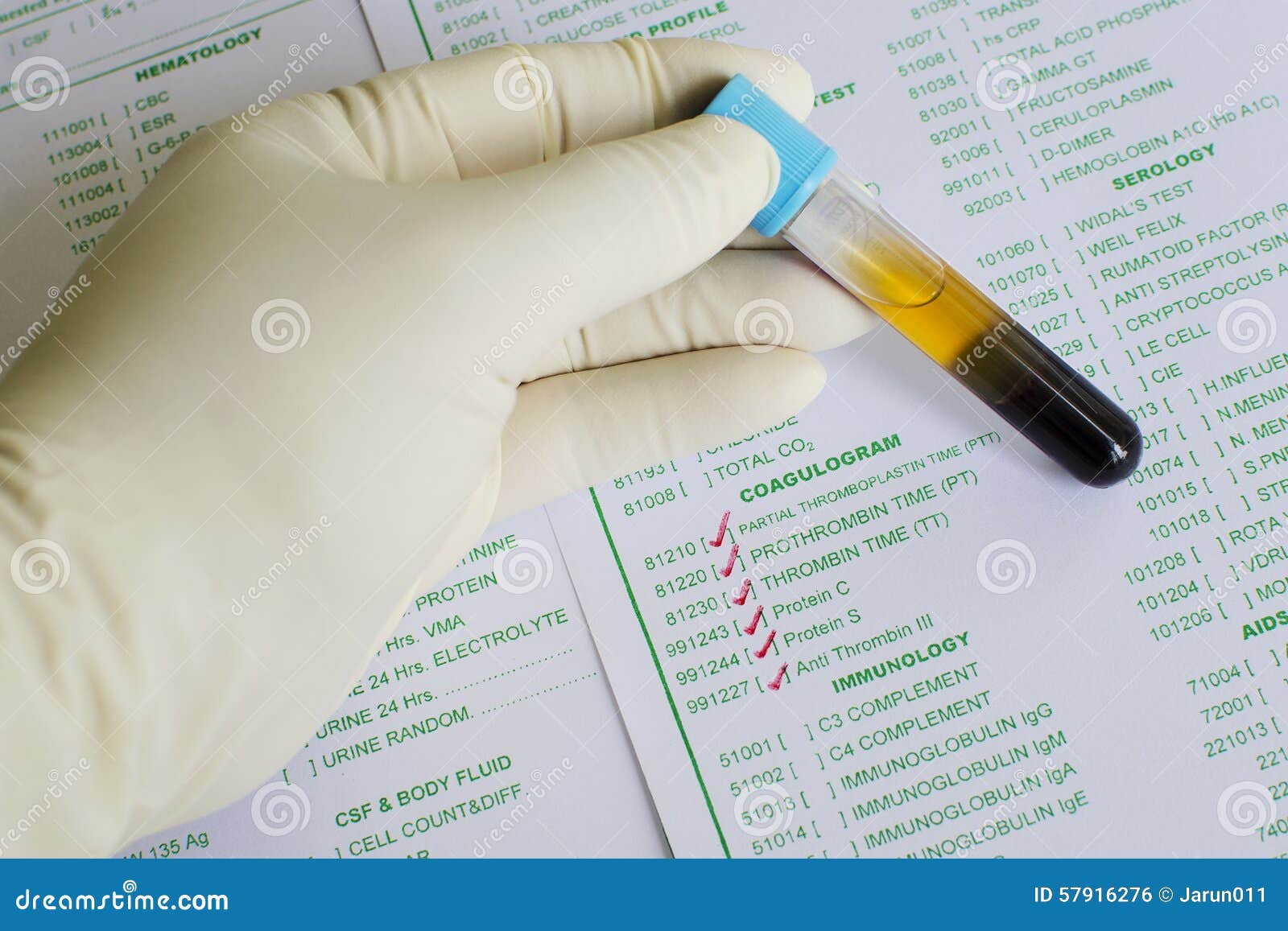 Blood sample tubes stock photo. Image of serology, sample - 57916276