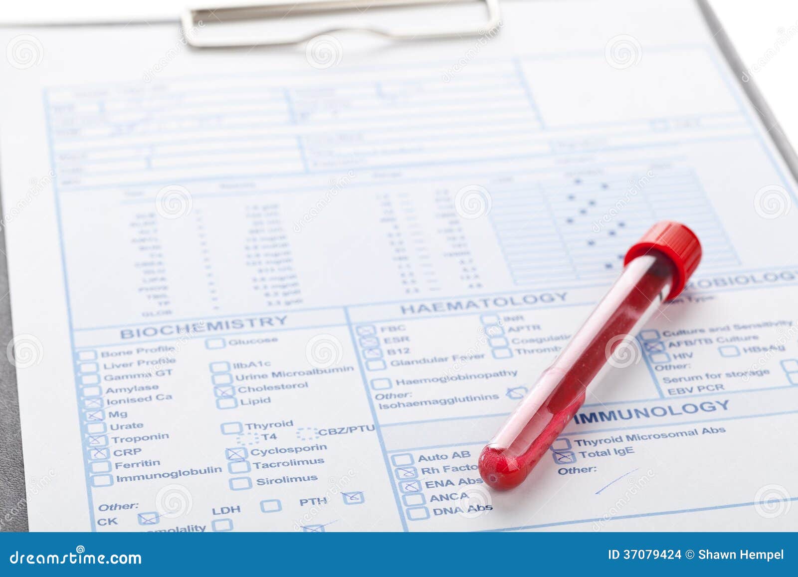 Blood sample stock photo. Image of industry, fluid, medical - 37079424