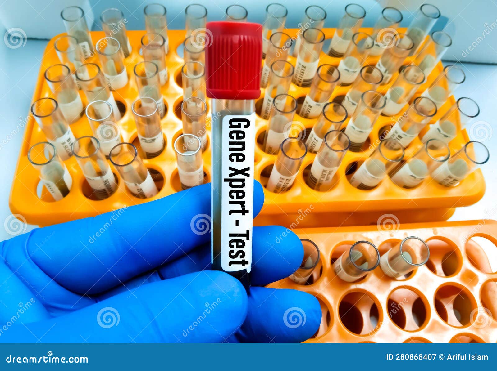 Blood Sample for Vibrio Cholerae Test Stock Image - Image of hematology ...