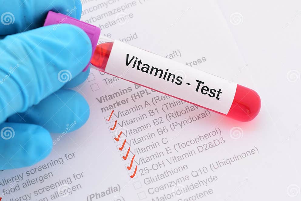 Vitamins test stock image. Image of carotene, research - 101313285