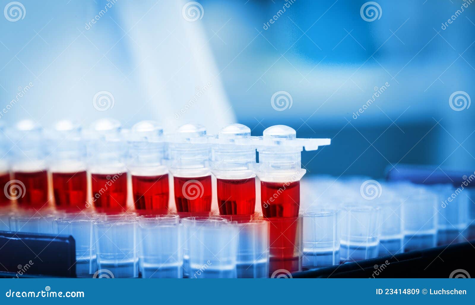 Blood samples stock image. Image of glassware, glass - 23414809