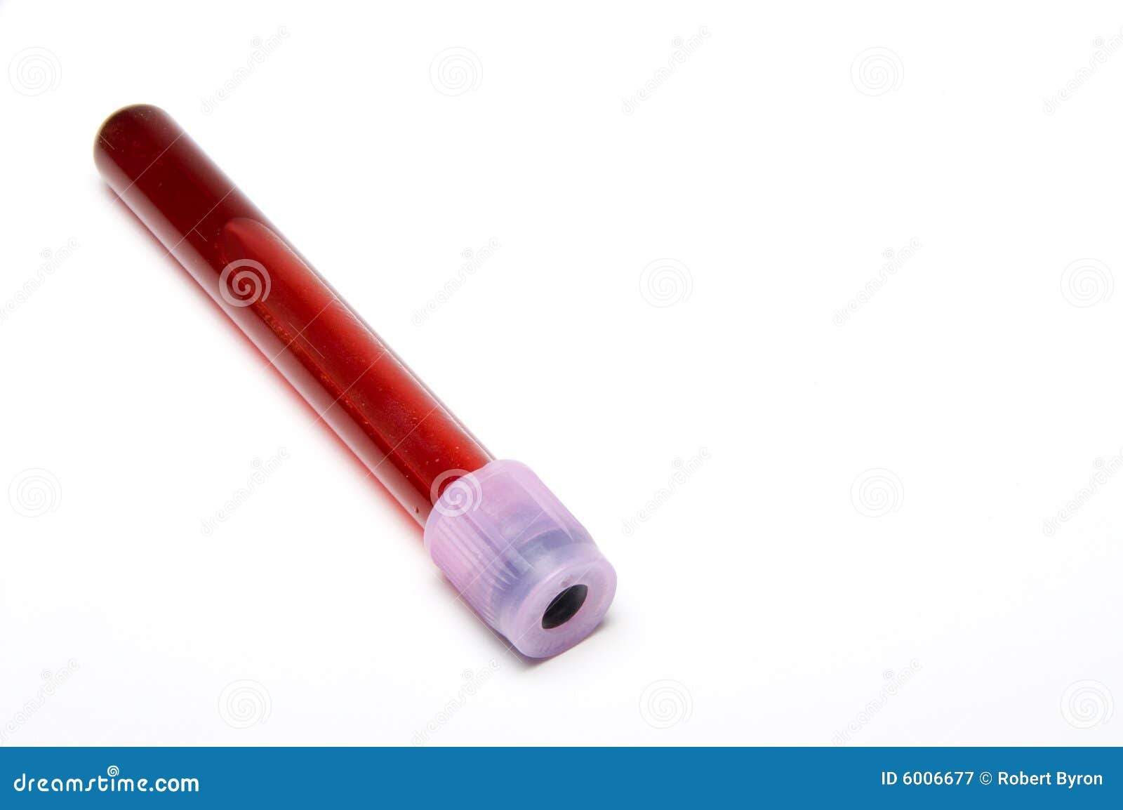 Blood Samples stock image. Image of test, analysis, tube - 6006677