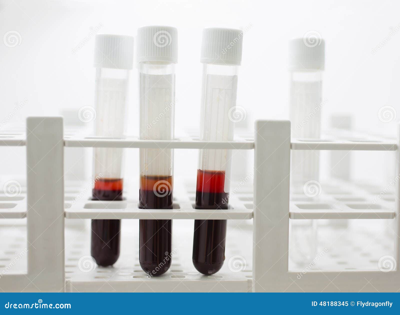 Blood Samples are Analyzes in the Container Stock Image - Image of ...