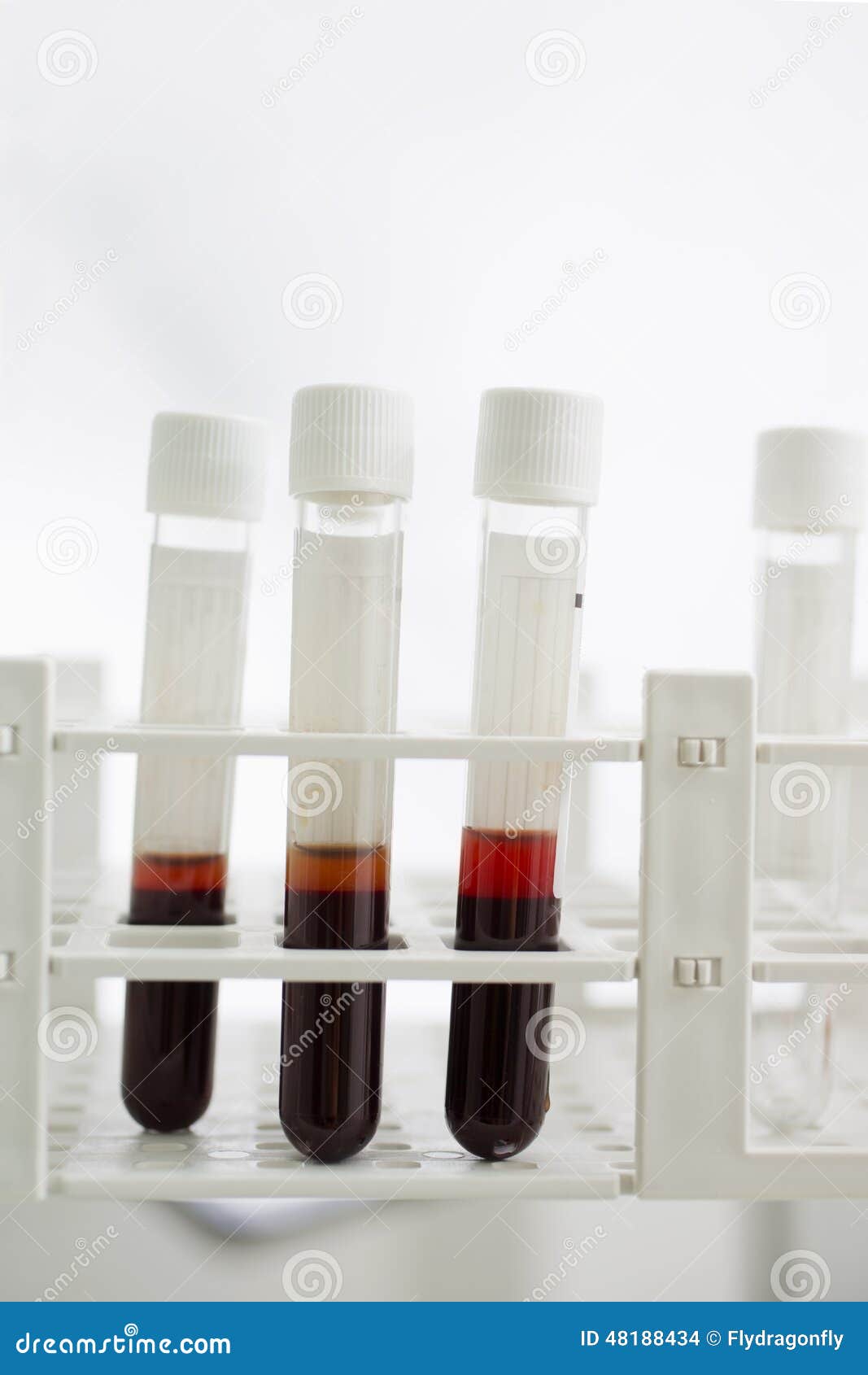Blood Samples are Analyzes in the Container Stock Photo - Image of ...