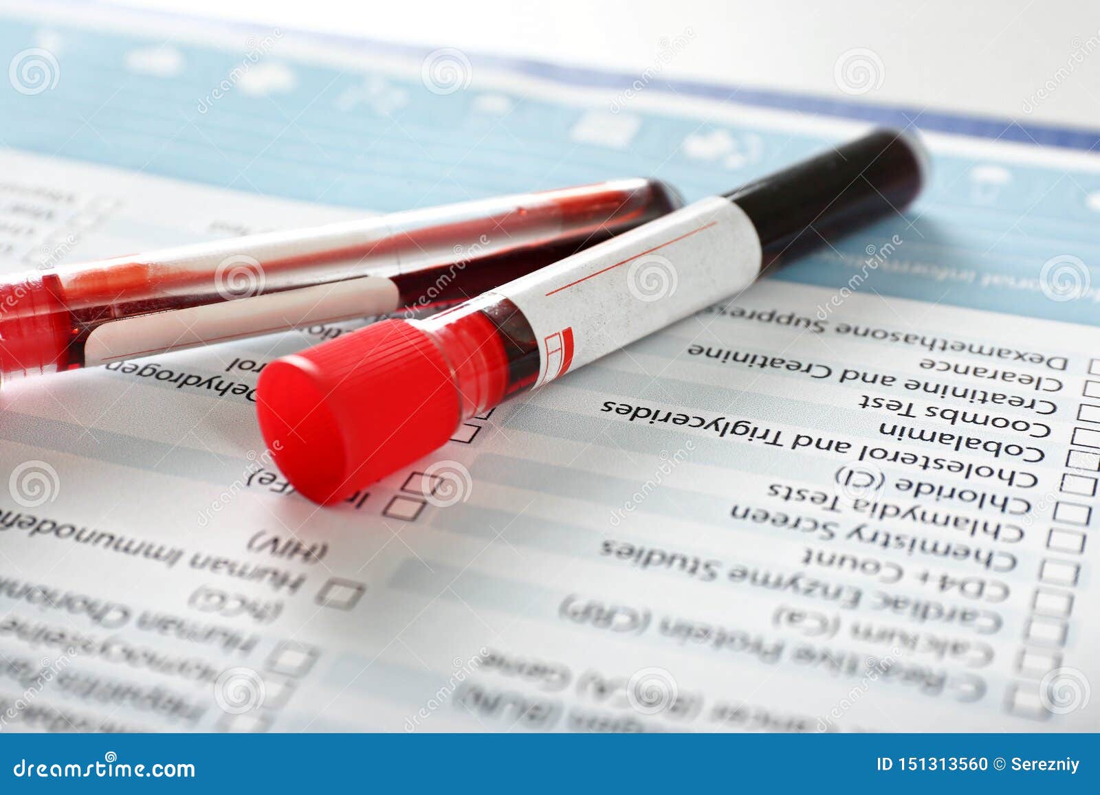 Blood Samples on Document with Result of Analyses Stock Photo - Image ...