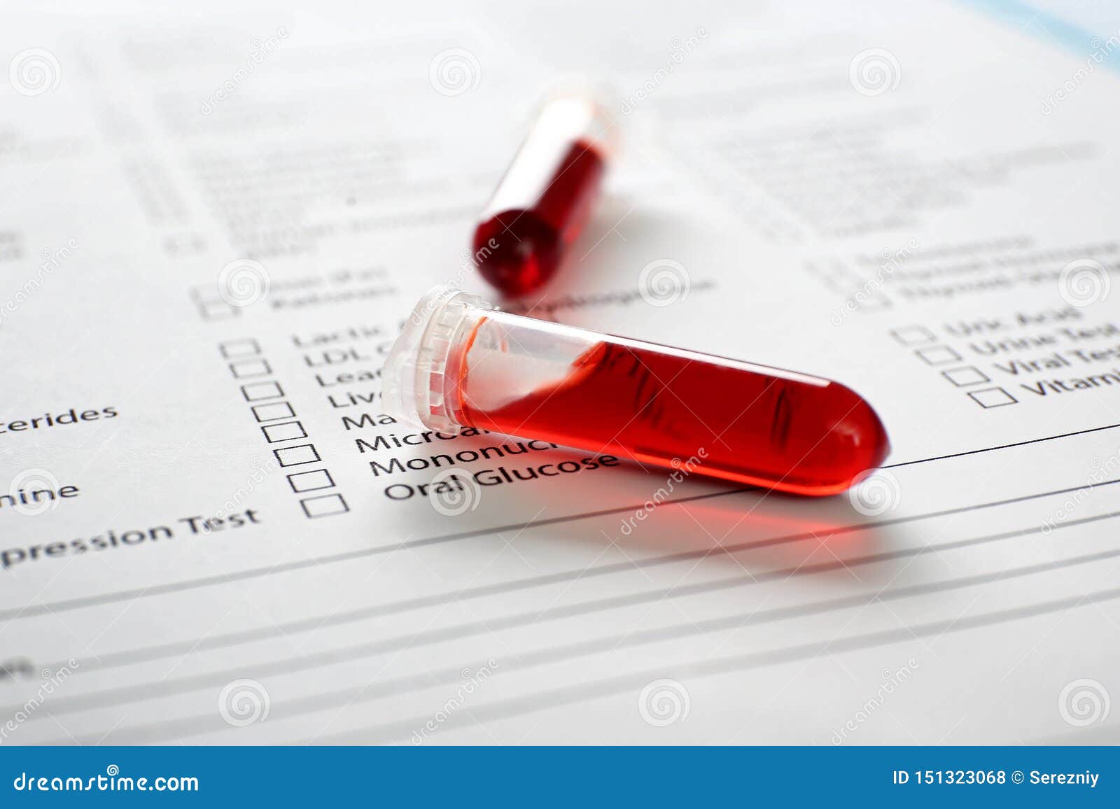 Blood Samples on Document with Result of Analyses Stock Photo - Image ...