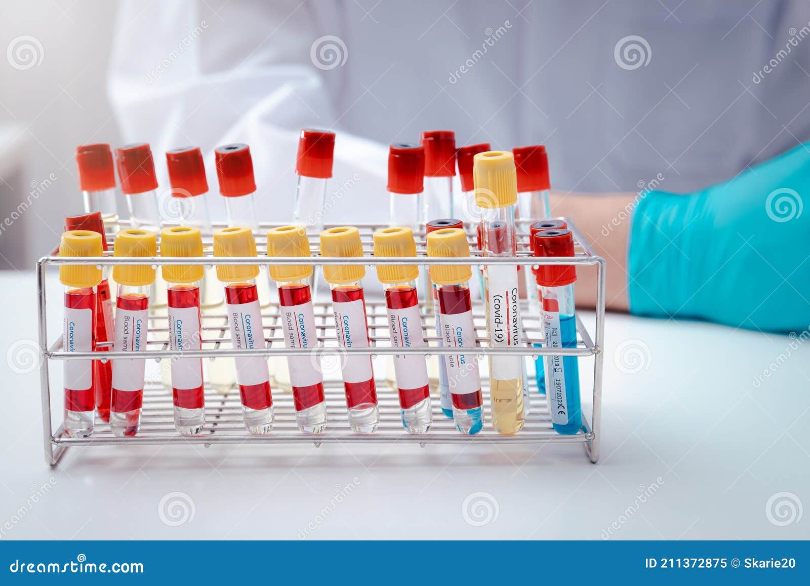 Blood Samples and Plasma in Tubes on Work Table in a Medical ...
