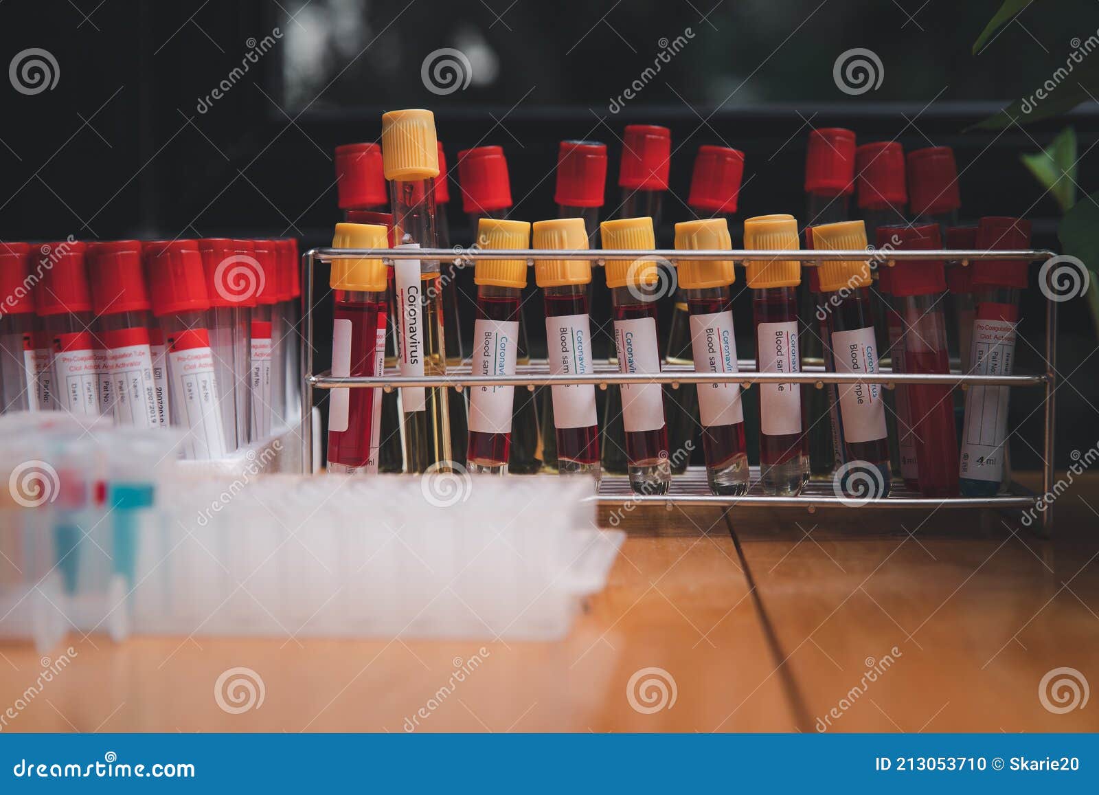 Blood Samples and Plasma in Tubes on Work Table in a Medical ...