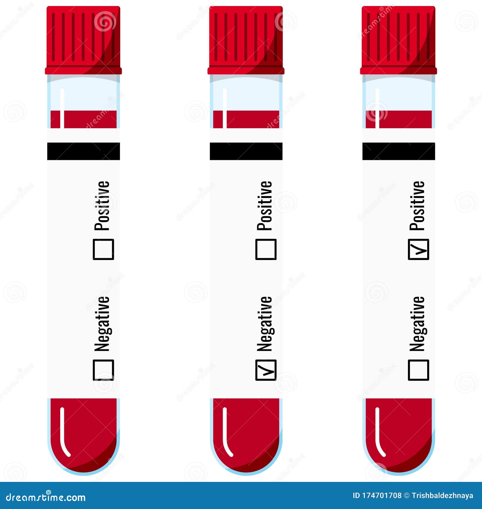 Phlebotomy Vector Illustration. Labeled Veins Blood Samples Process ...