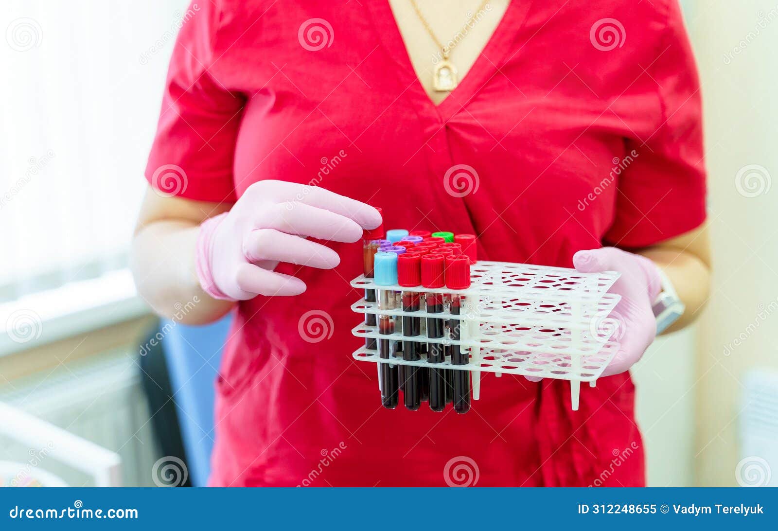 Blood Samples for Research in Microtubes. Testing in Laboratory ...