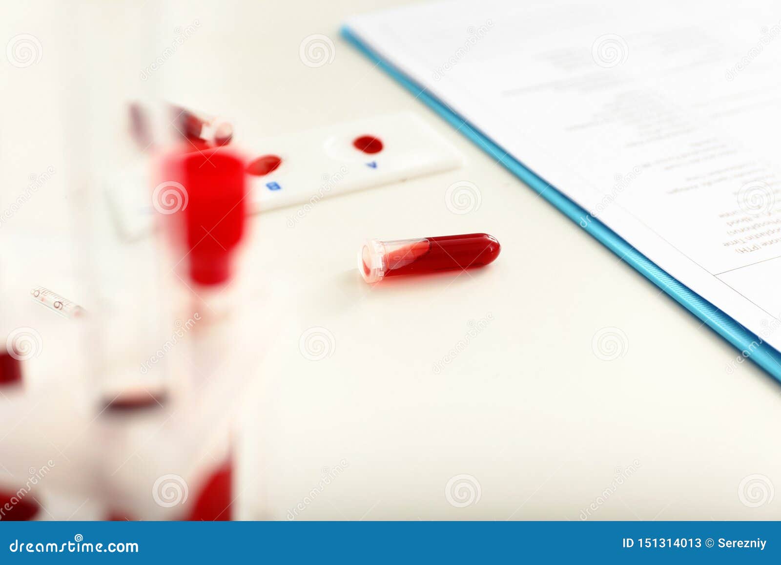 Blood Samples on Table in Laboratory Stock Image - Image of clinic ...