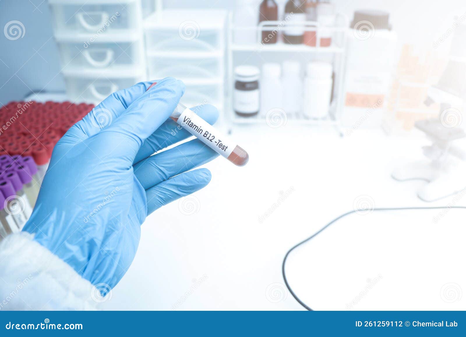 Blood Samples for Testing Vitamin B12 in the Laboratory Stock Photo ...
