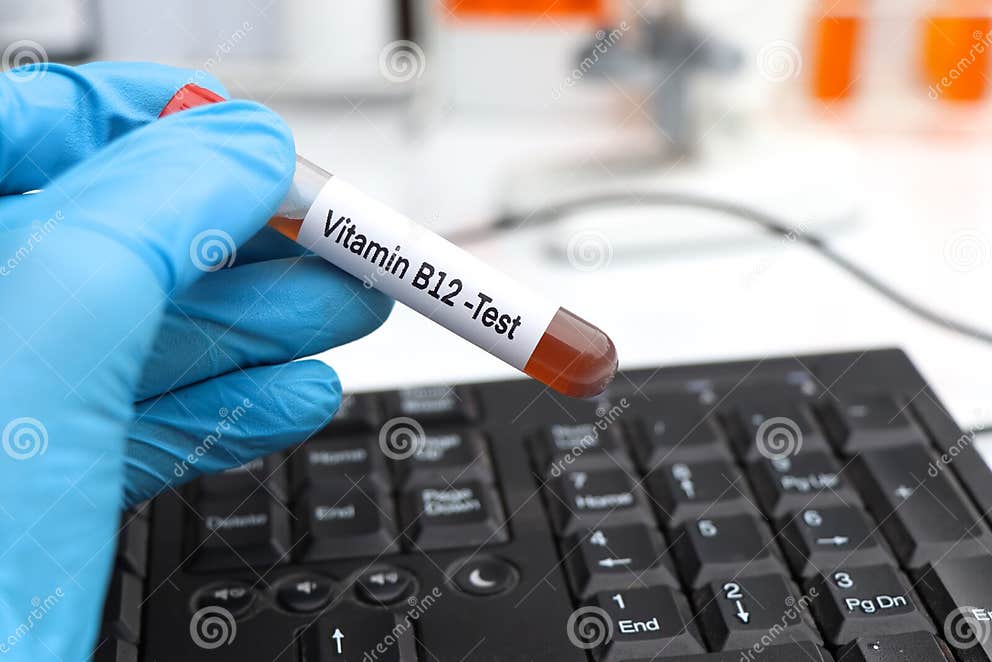Blood Samples for Testing Vitamin B12 in the Laboratory Stock Photo ...