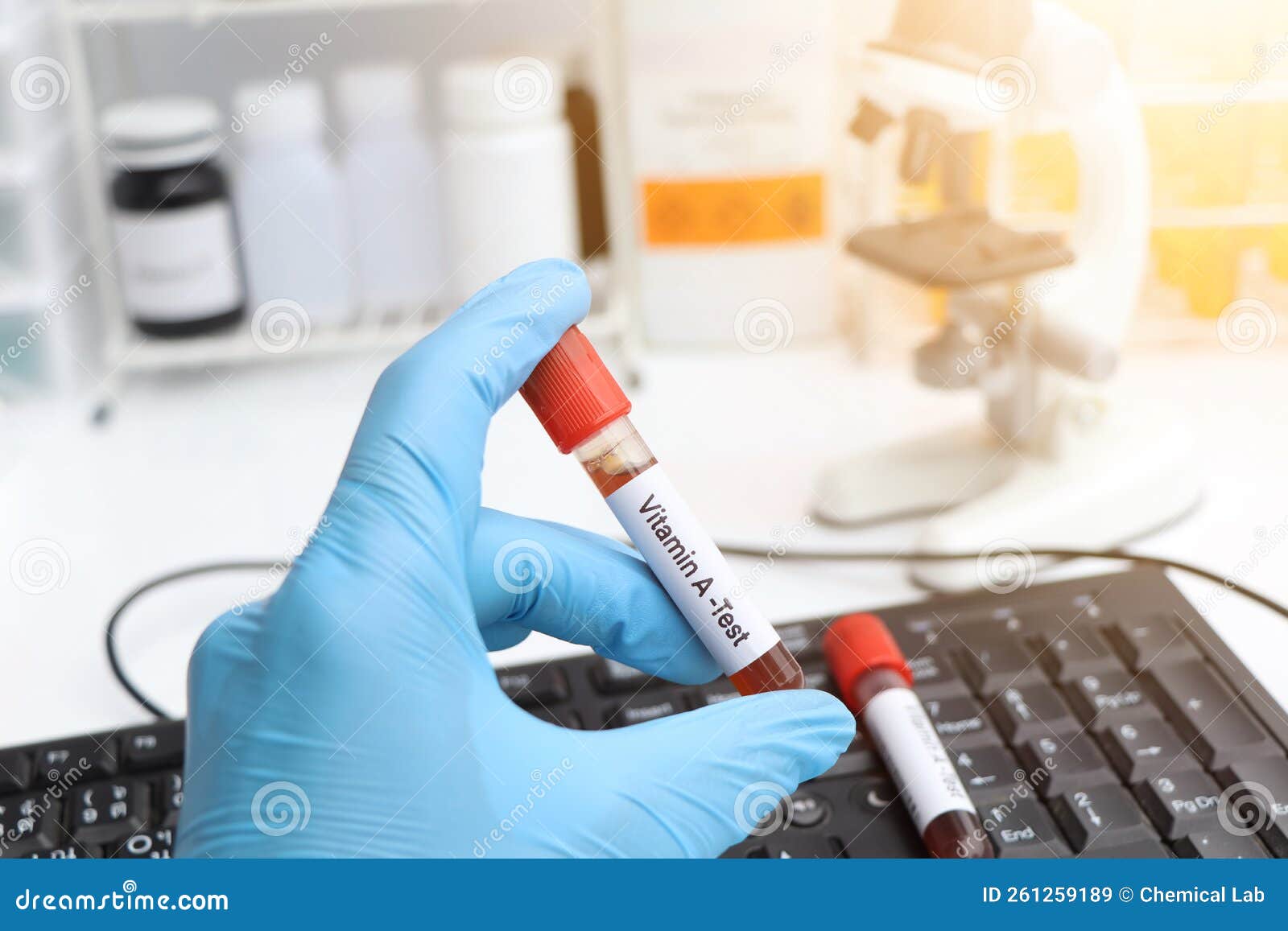 Blood Samples for Testing Vitamin a in the Laboratory Stock Image ...