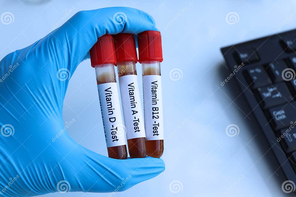 Blood Samples for Testing Vitamin in the Laboratory Stock Photo - Image ...