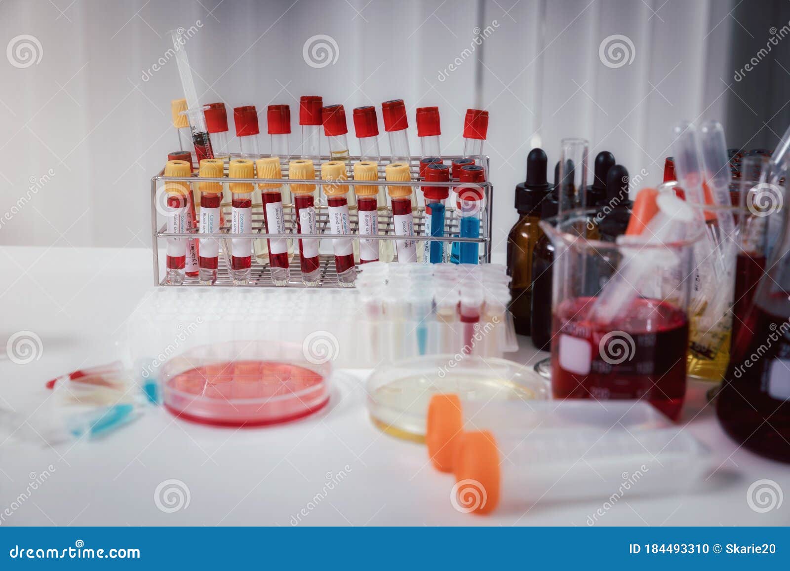 Blood Samples in Tubes and Syringes on Work Table in a Medical ...
