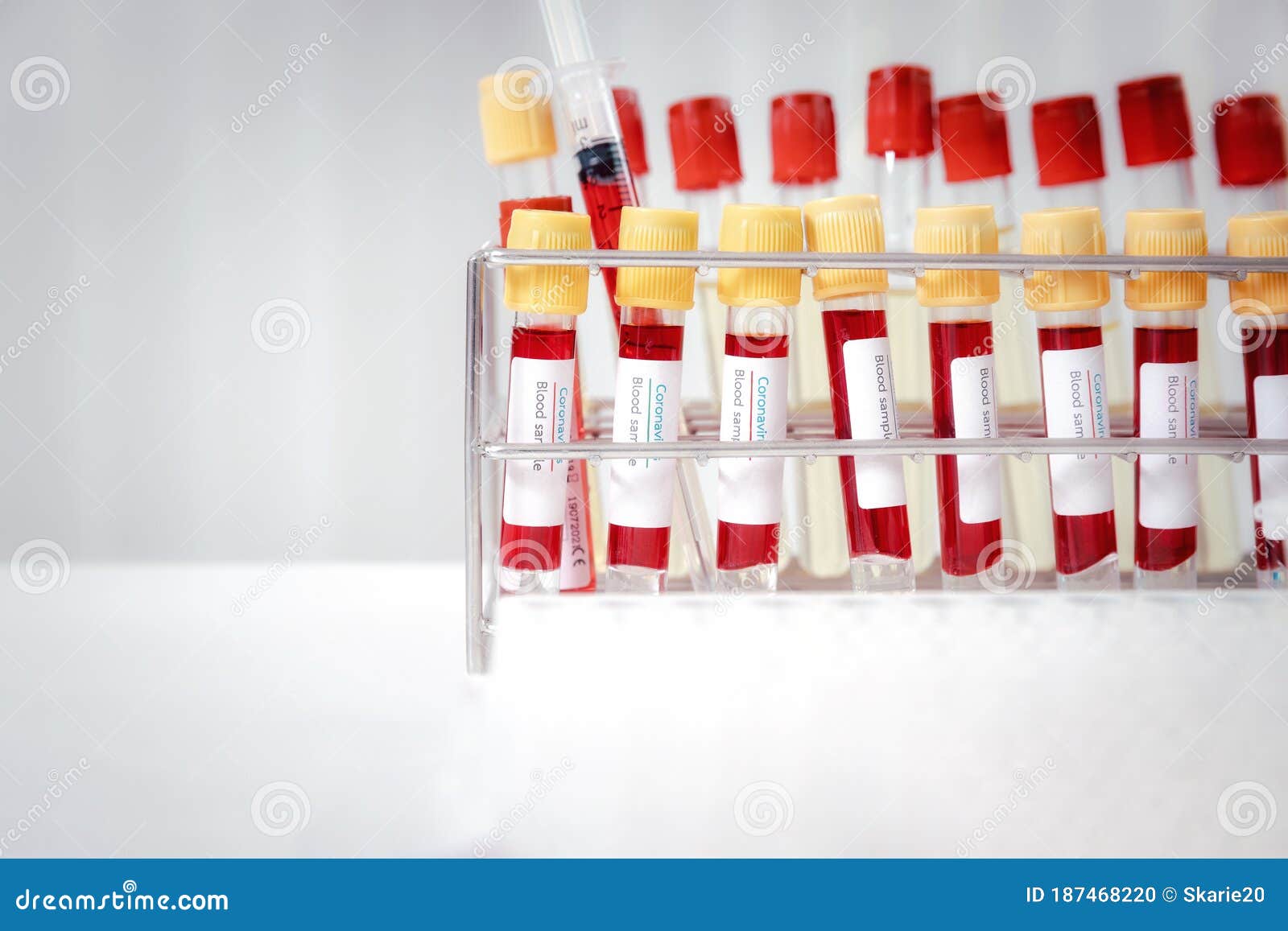 Blood Samples in Tubes and Syringes on Work Table in a Medical ...