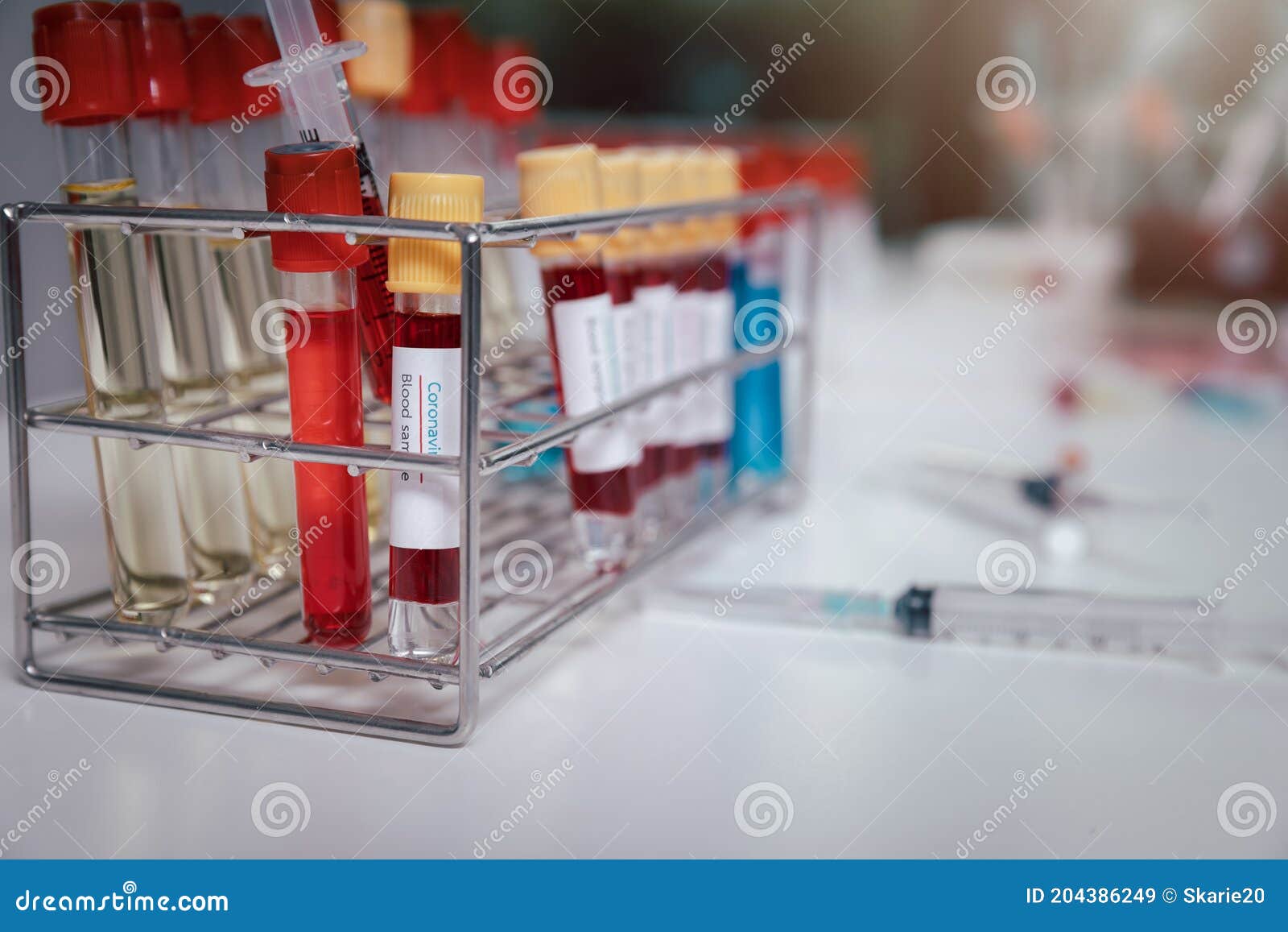 Blood Samples in Tubes and Syringes on Work Table in a Medical ...