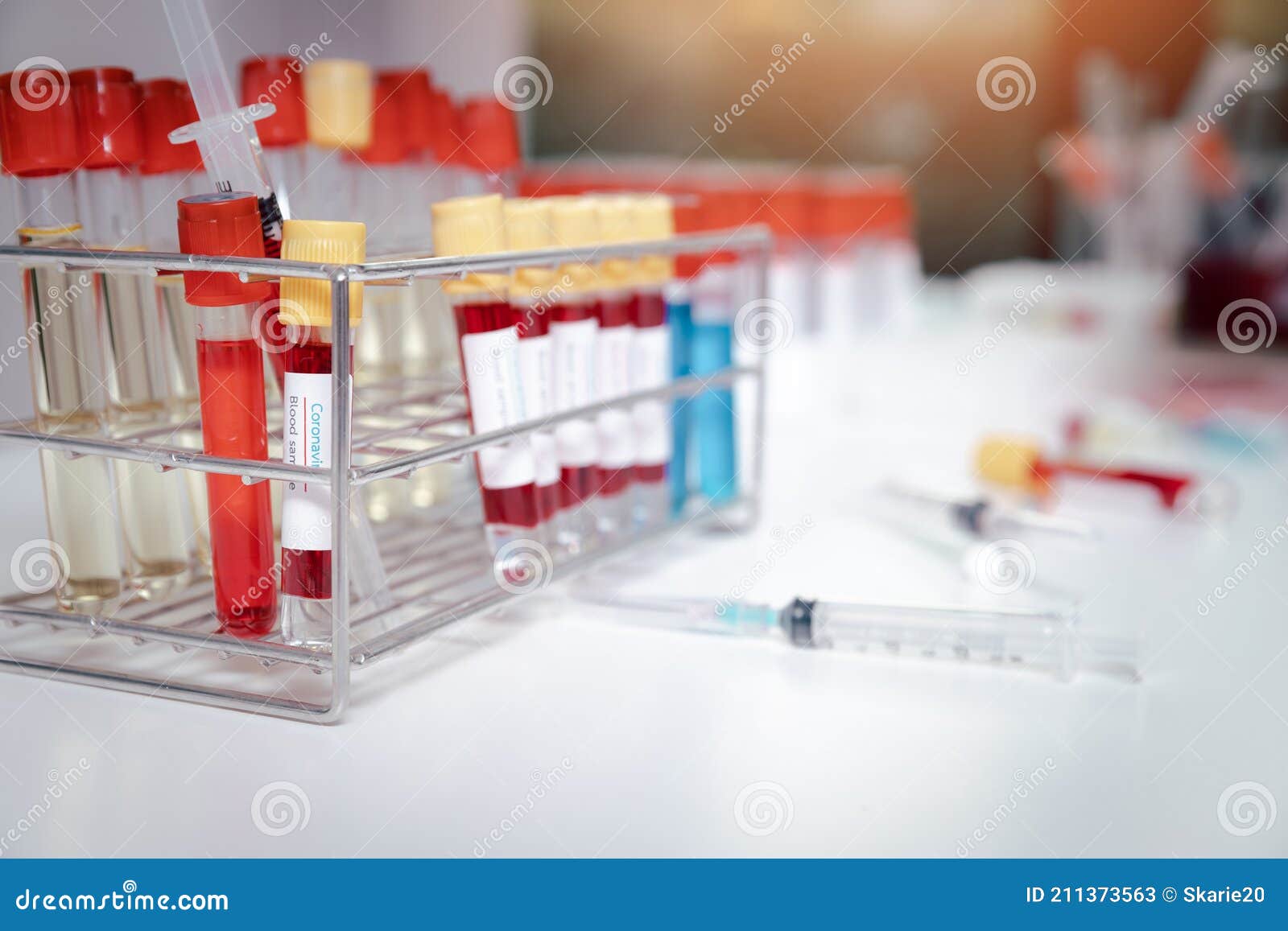 Blood Samples in Tubes and Syringes on Work Table in a Medical ...