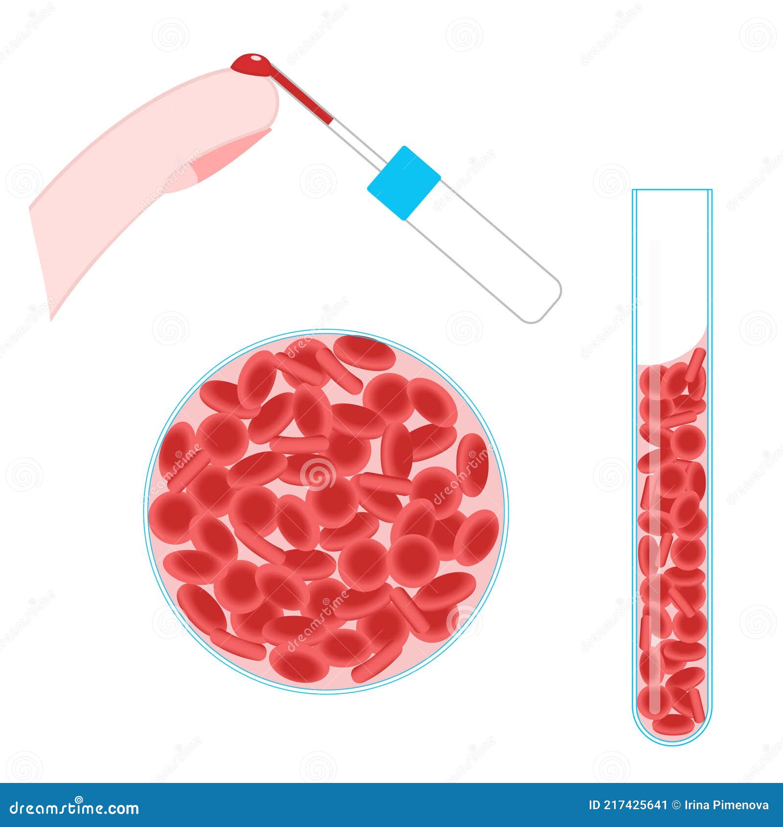 Blood Sampling from a Finger for Analysis Stock Vector - Illustration ...
